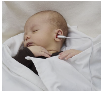 OtoRead™ | How to Perform TEOAE | Interacoustics